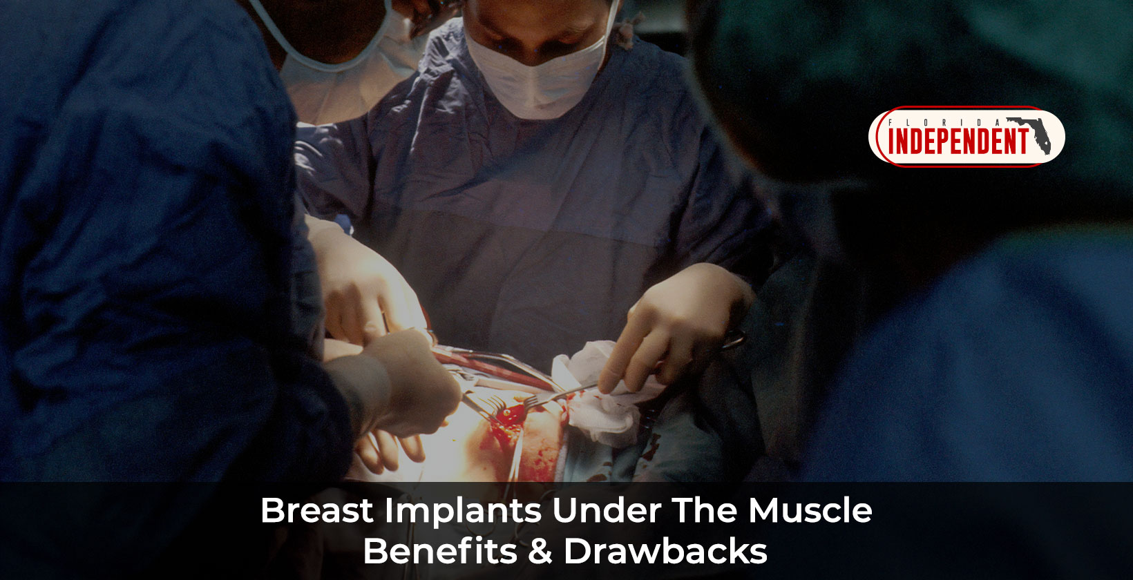 Breast Implants Under The Muscle - Florida Independent